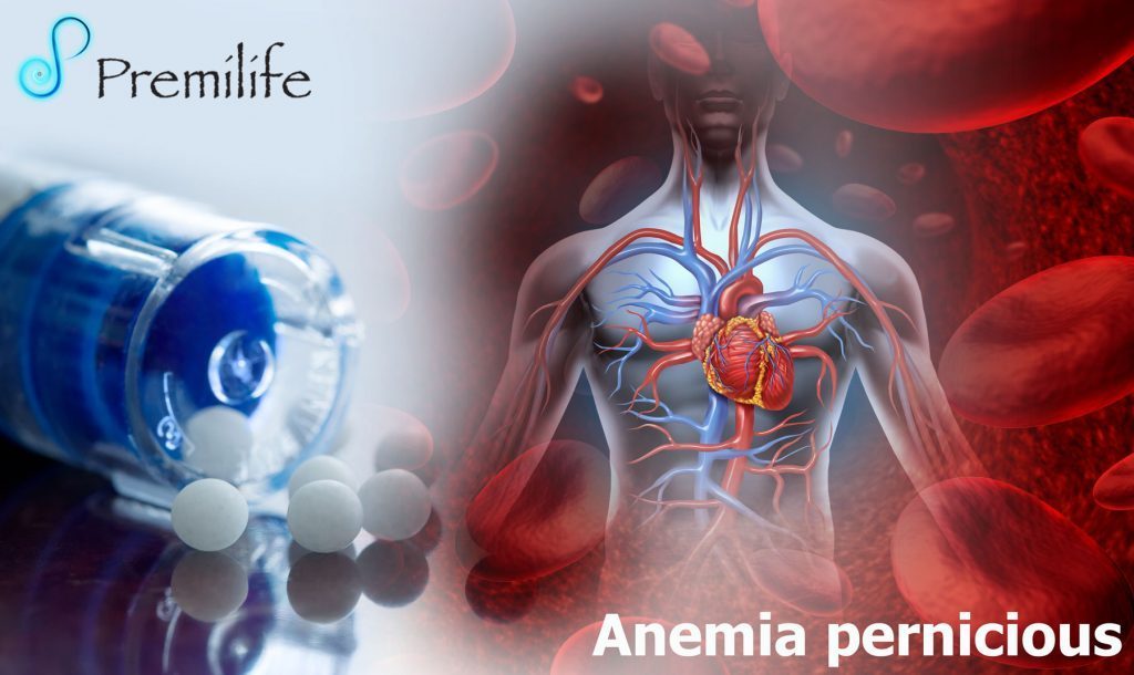Anemia Pernicious and Secondary - Homeopathic Remedies