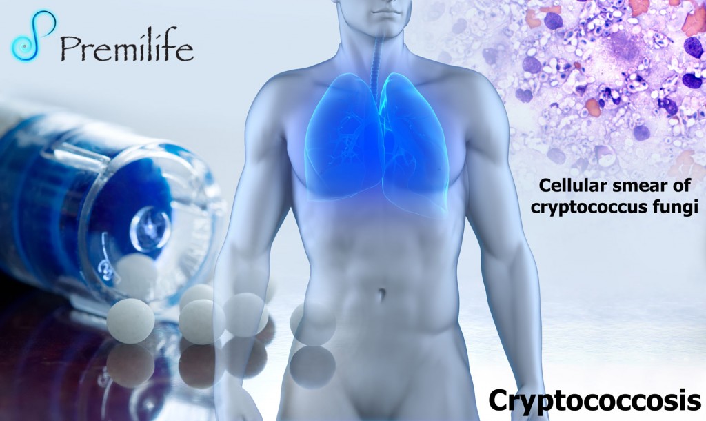 Cryptococcosis | Premilife - Homeopathic Remedies