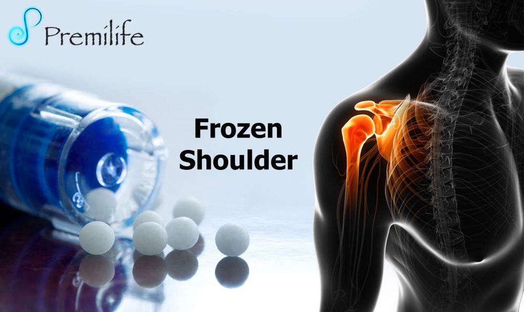 Frozen Shoulder | Premilife - Homeopathic Remedies