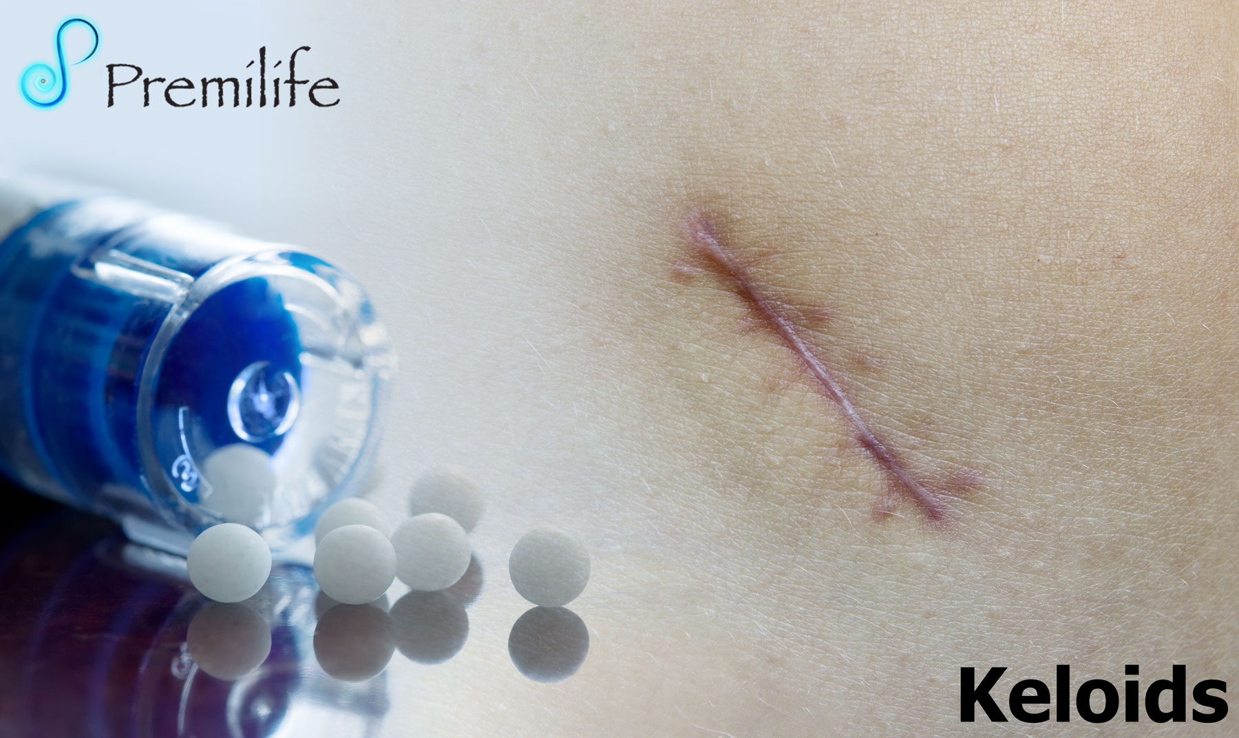 Keloids | Premilife - Homeopathic Remedies