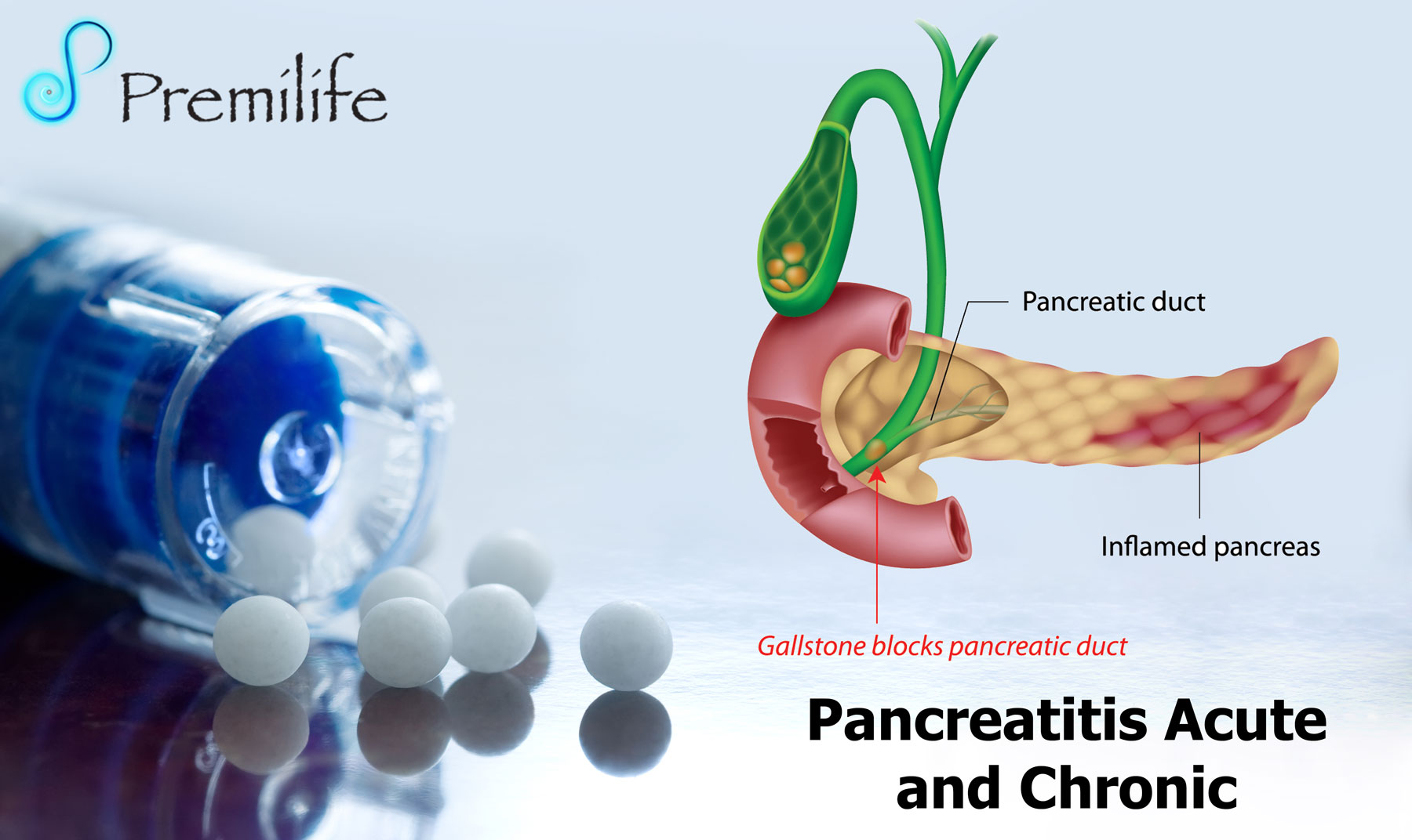 Pancreatitis Acute and Chronic | Premilife - Homeopathic Remedies