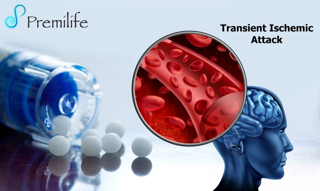 Transient Ischemic Attack | Premilife - Homeopathic Remedies