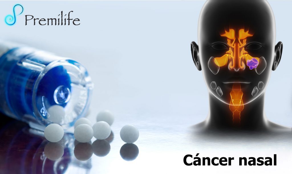 Nasal Cancer | Premilife - Homeopathic Remedies