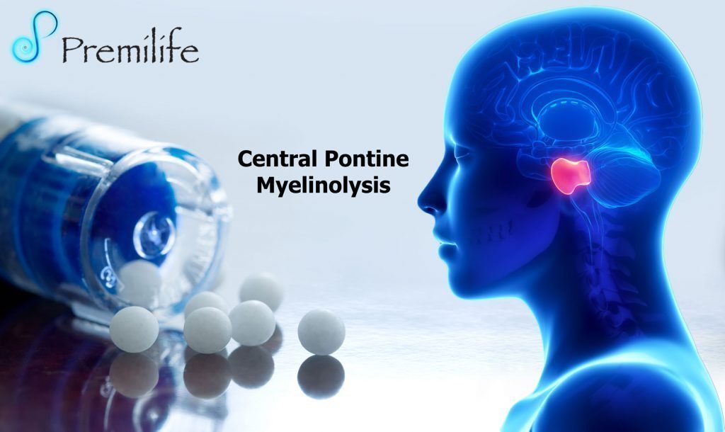 Central Pontine Myelinolysis | Premilife - Homeopathic Remedies