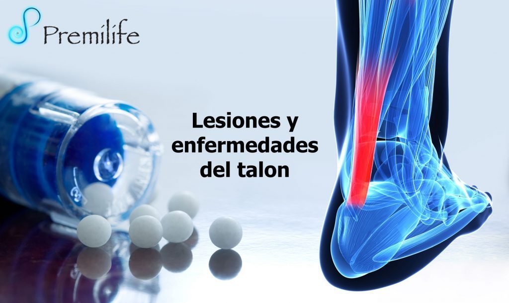 Lesiones y enfermedades del talon - Homeopathic Remedies