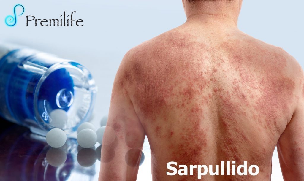 Sarpullido | Premilife - Homeopathic Remedies