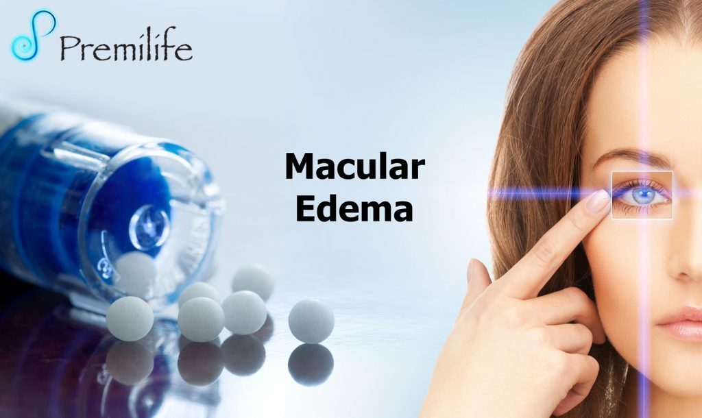 Macular Edema | Premilife - Homeopathic Remedies